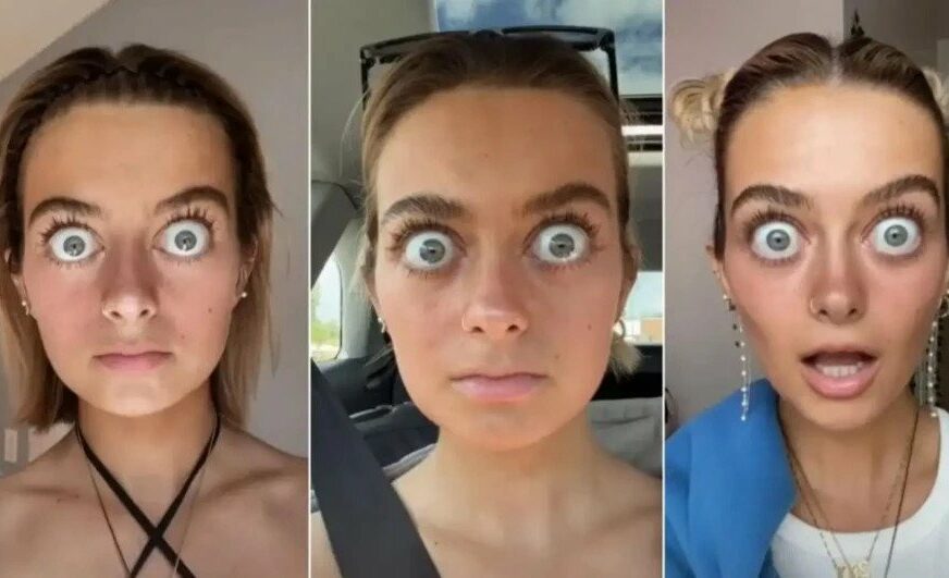 Ima 'ogromne' oči: Kažu mi da sam kao Gollum iz Gospodara prstenova ...