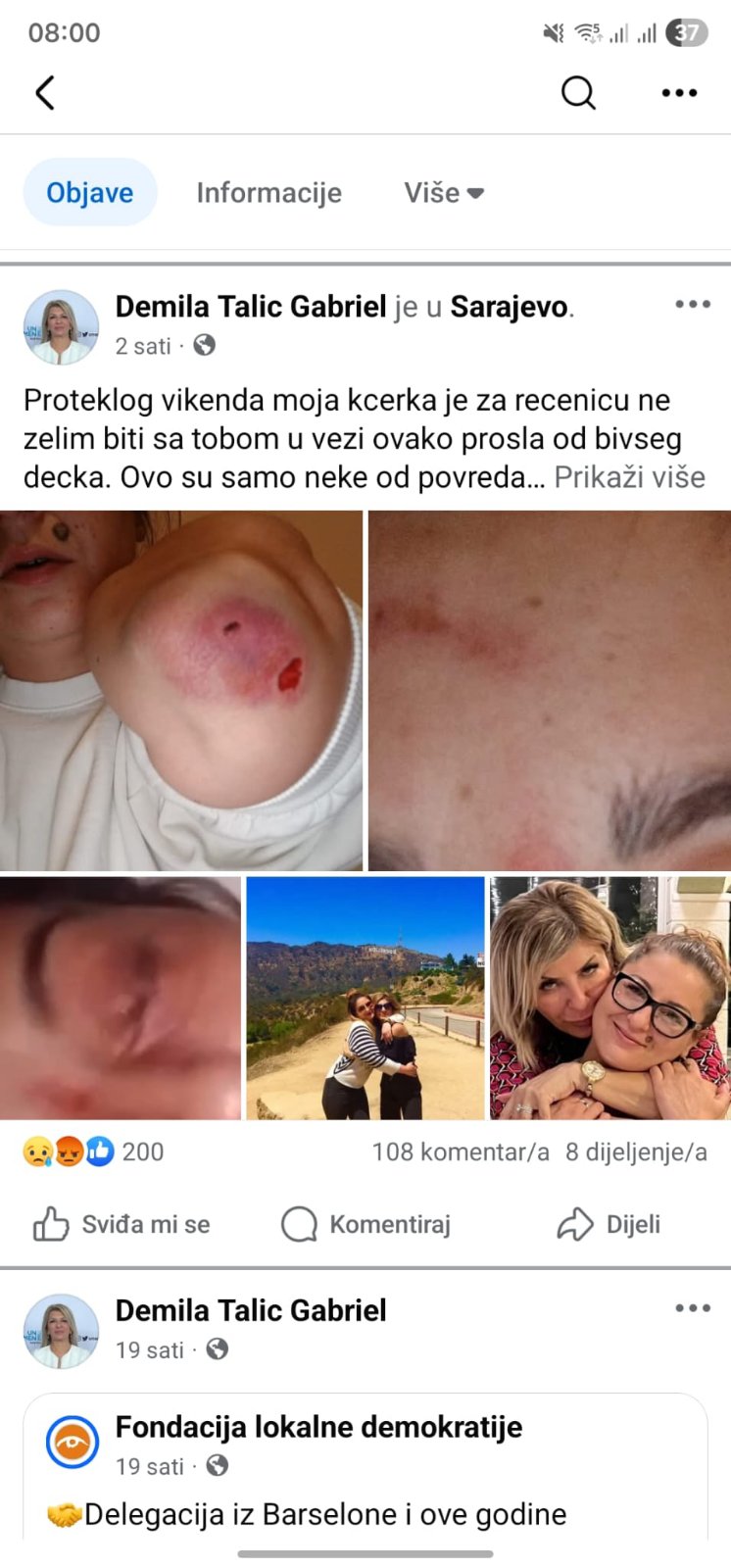 HOROR Kćerku Đemile Talić Gabriel pretukao bivši momak. Tukao je satima... - BosnaInfo